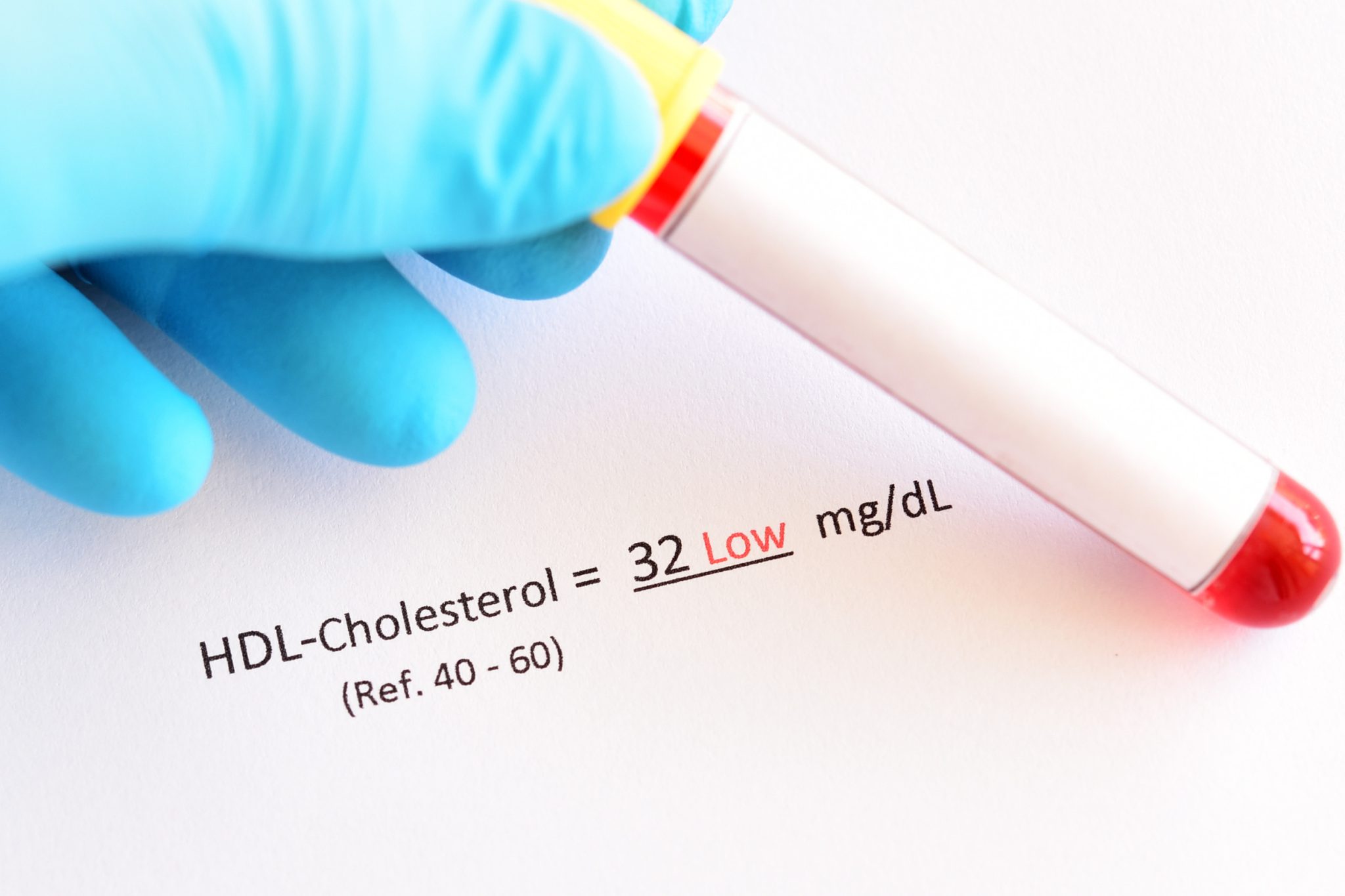 Areplex - opinie, wskazania, działanie, dawkowanie
