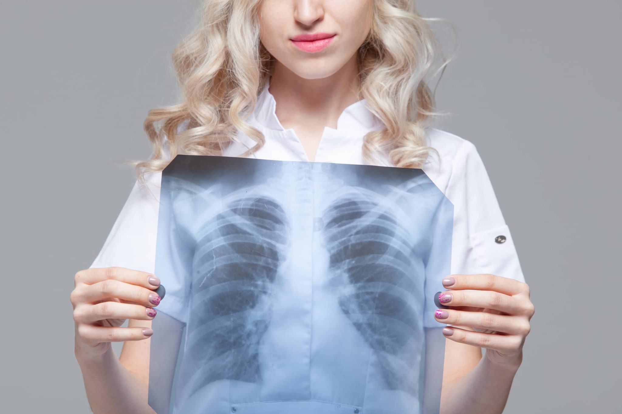 Rentgen (RTG) klatki piersiowej - jak wygląda? Jak przygotować się do ...