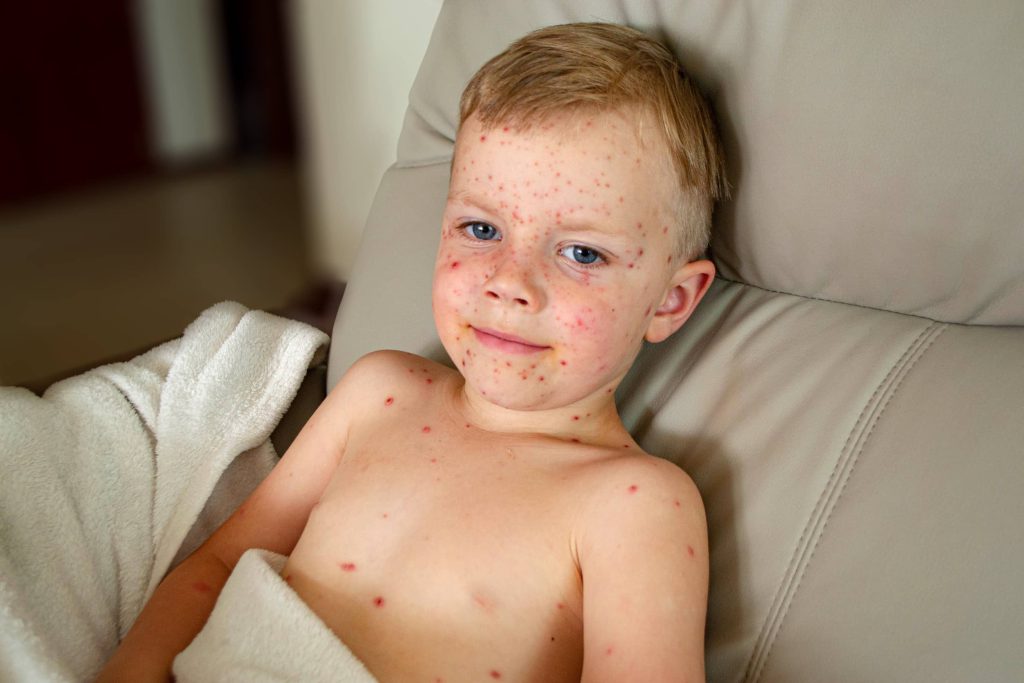 Systen 50 - opinie, wskazania, działanie, dawkowanie