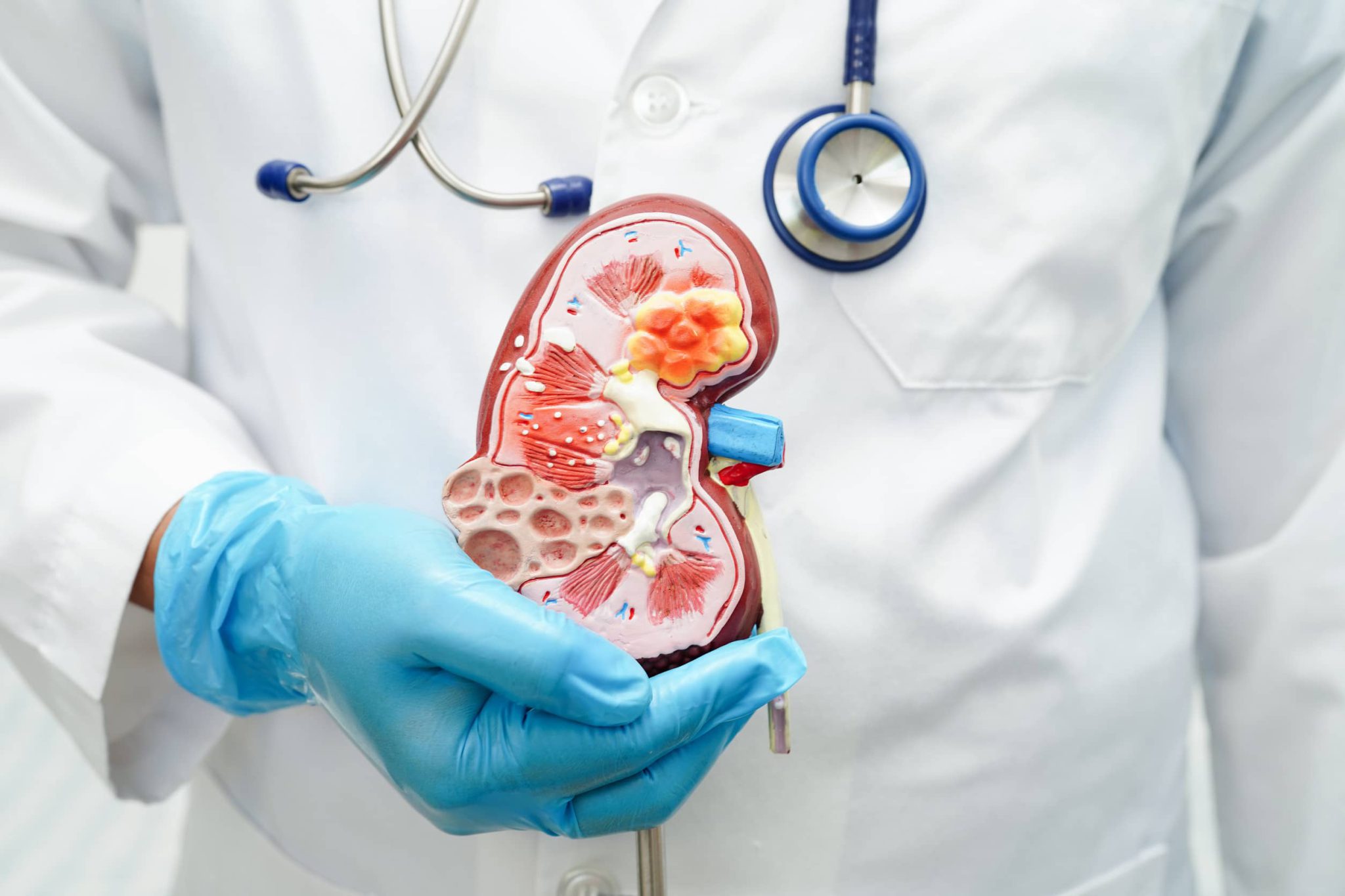 Spironol - opinie, wskazania, działanie, dawkowanie