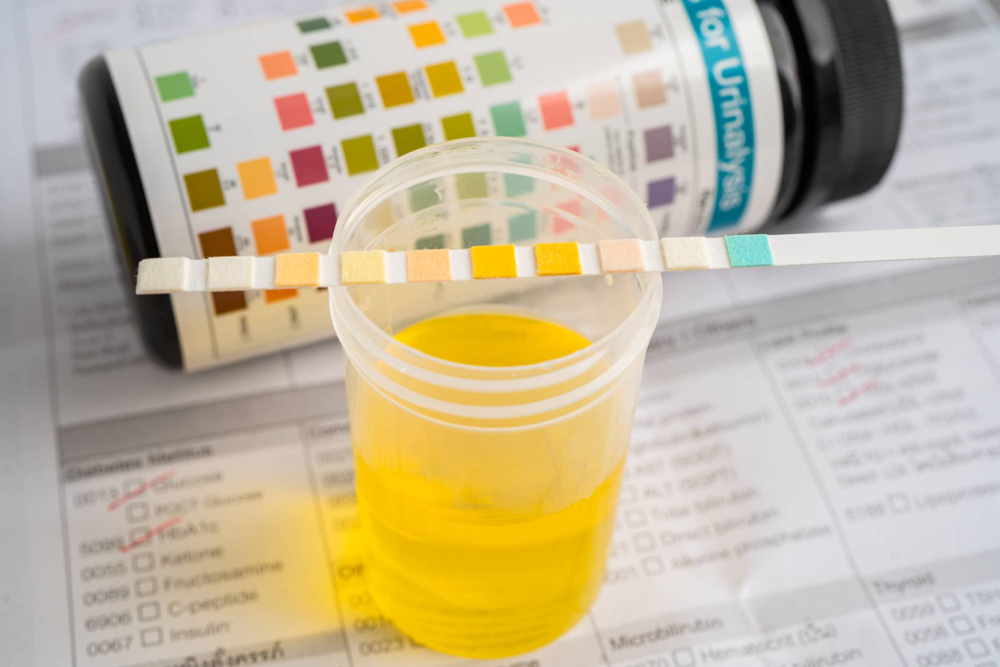 Spironol - opinie, wskazania, działanie, dawkowanie