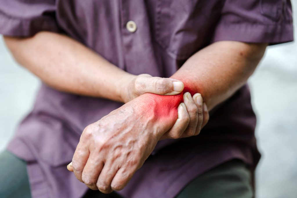 Colchicum Dispert - opinie, wskazania, działanie, dawkowanie