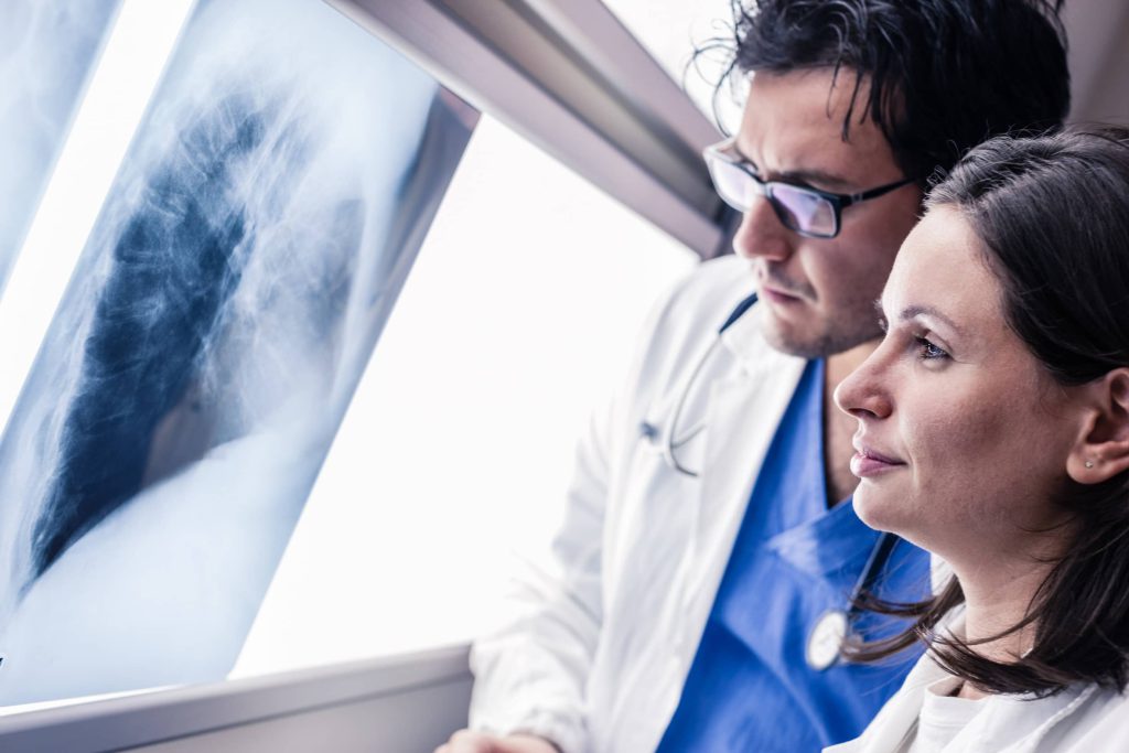 Ismigen - dawkowanie, jak stosować?