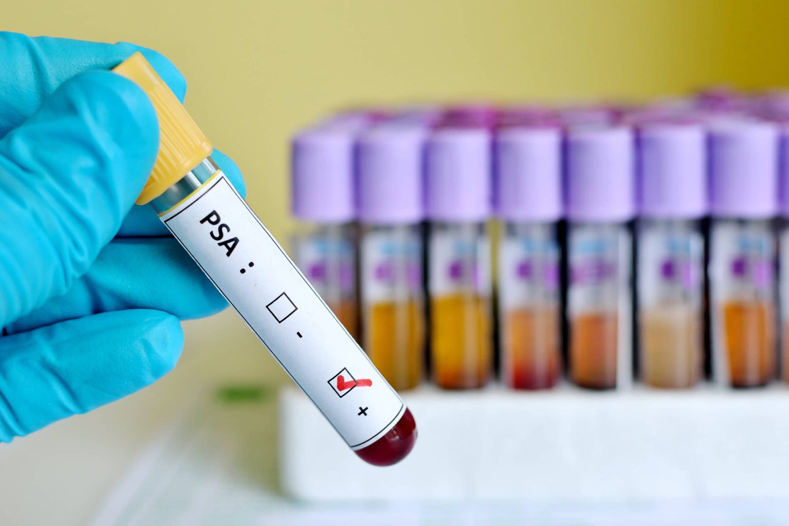 Symlosin SR opinie i ulotka - dawkowanie, skutki uboczne | o-lekach.pl