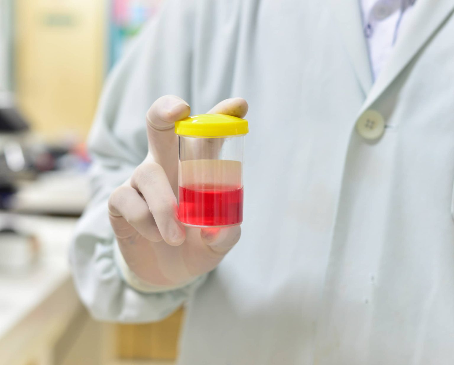 Spironol 100 - ulotka, wskazania, zamienniki