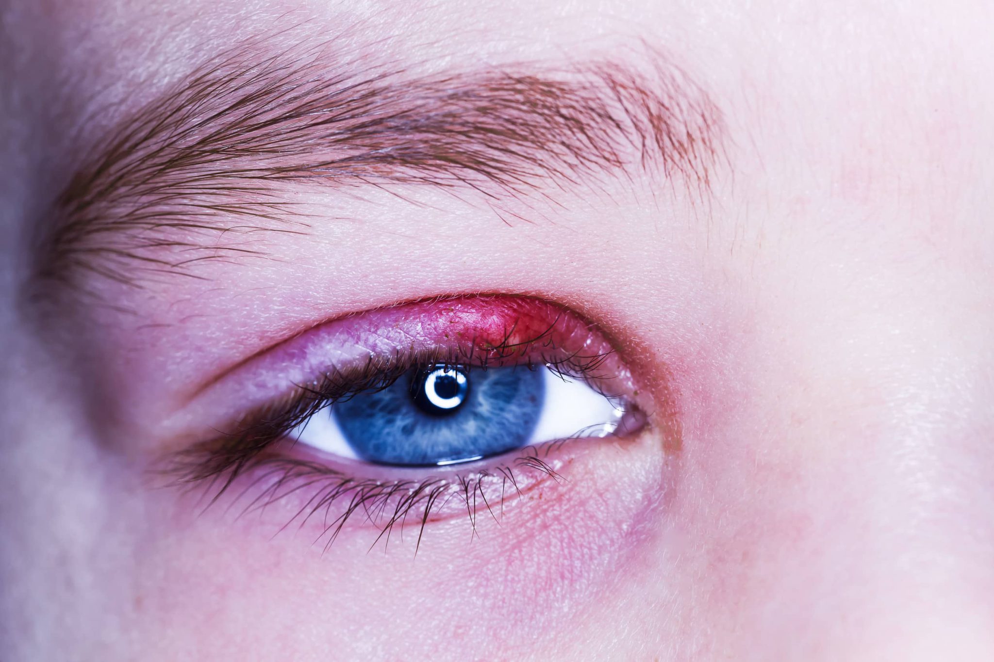 Oftahist - ulotka, wskazania, zamienniki