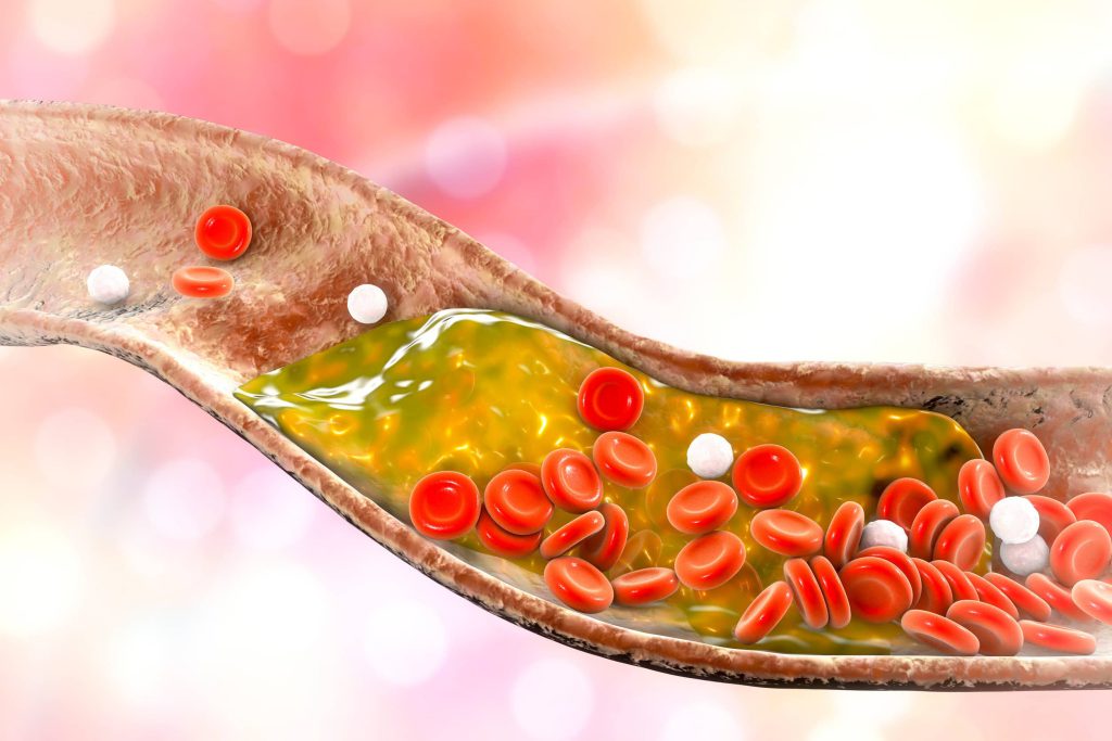 Optilyte - opinie, wskazania, działanie, dawkowanie